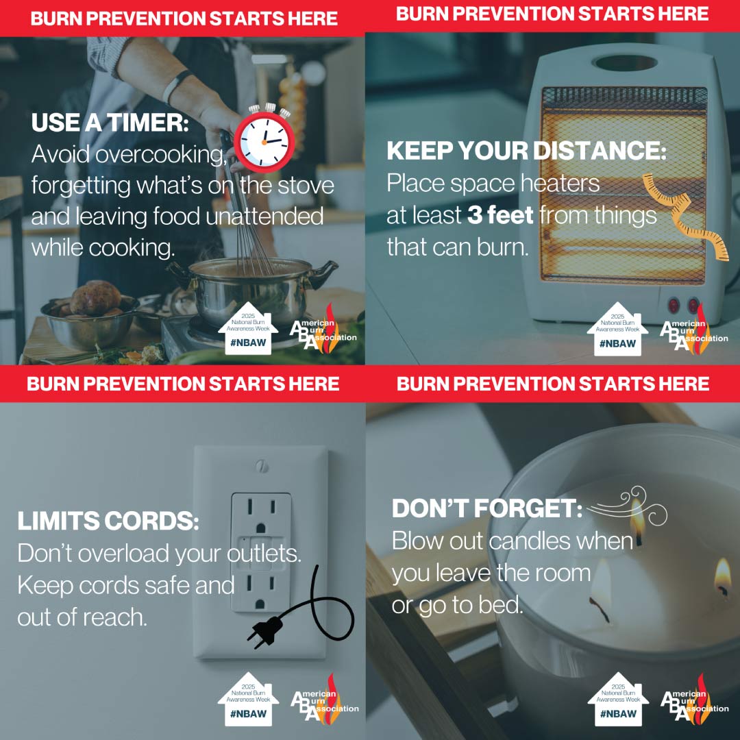 National Burn Awareness Week: Preventing Burns in the Homes - Lynnwood ...